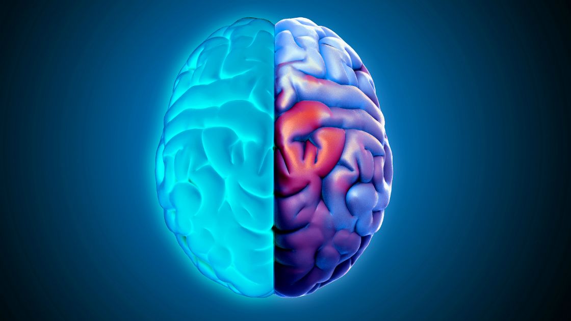 Operacja Zdrowie!: Mózg - programy, Oglądaj na TVP VOD